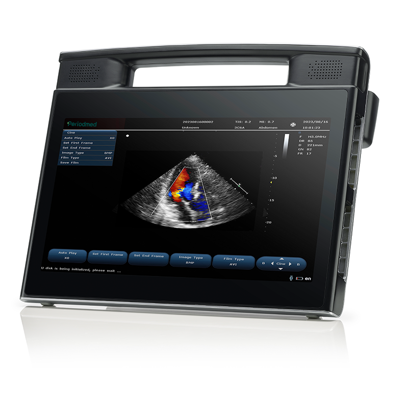 News - Explore the History of Ultrasound