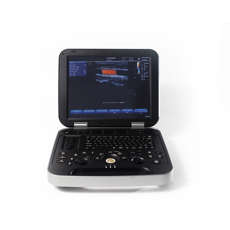 China Yonker Color Doppler Ultrasound Machine YK-UL8 Manufacturer and ...